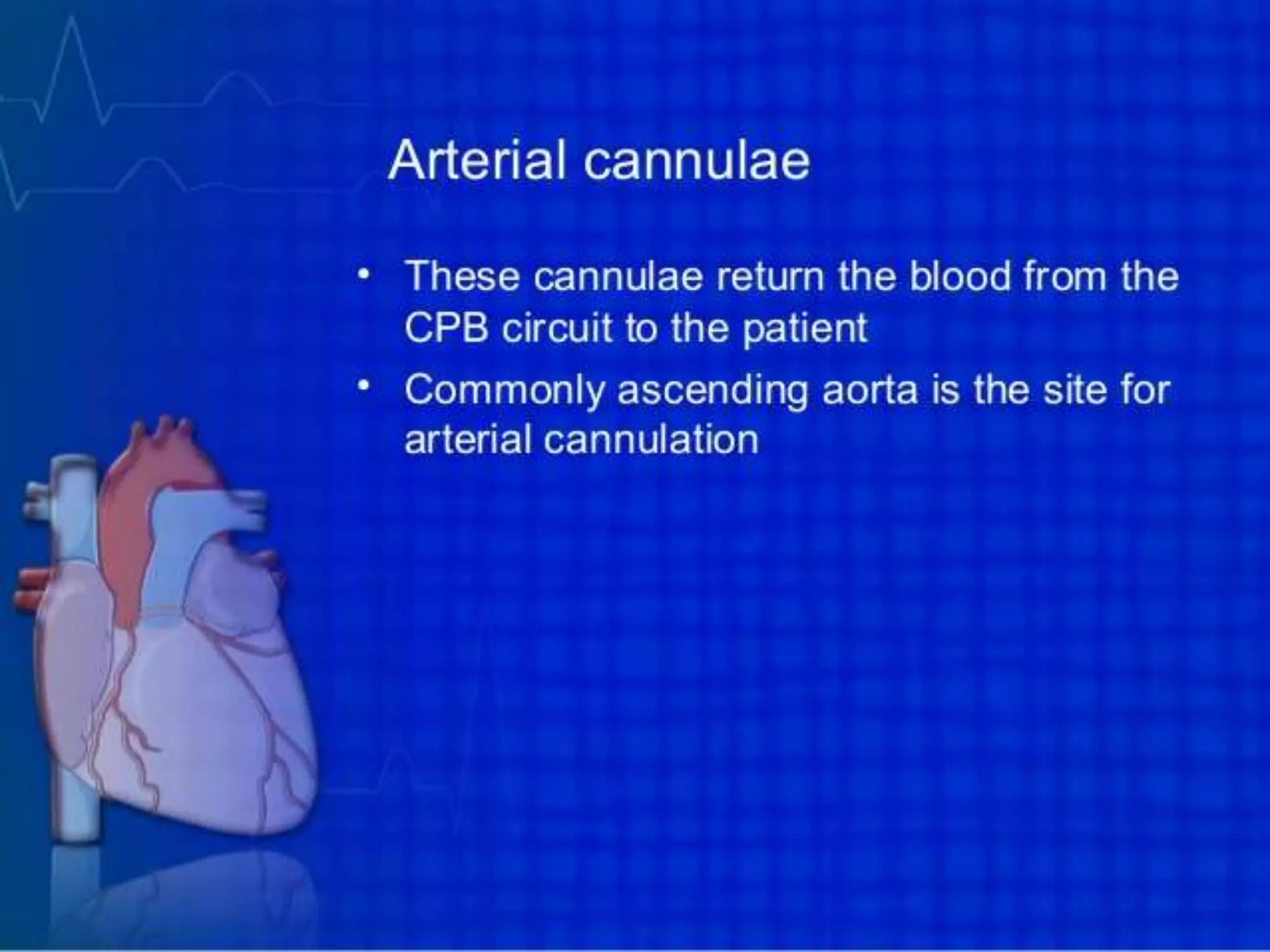 Cannulation and cardiopulmonary bypass. | PPTX