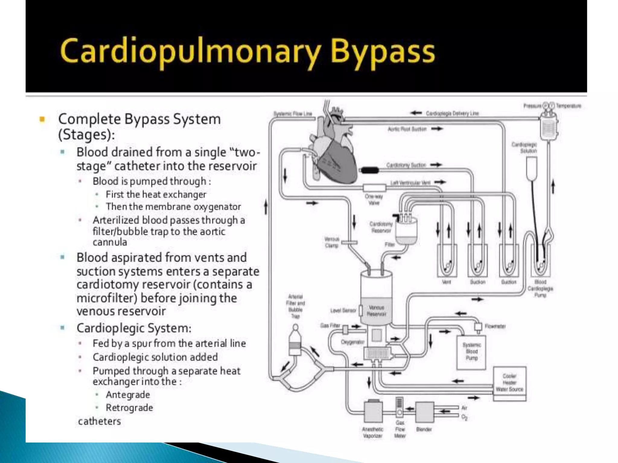 Cannulation and cardiopulmonary bypass. | PPTX