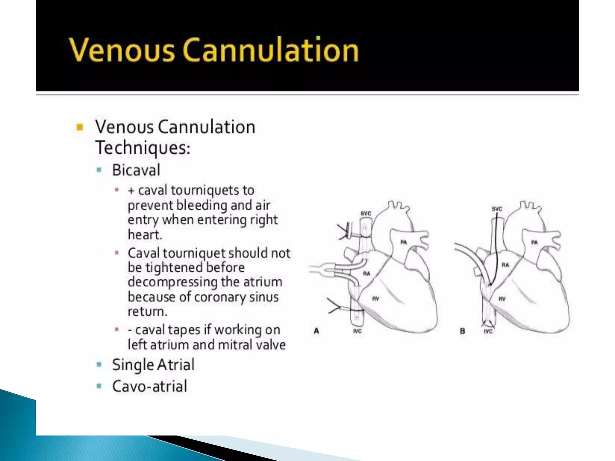 Cannulation and cardiopulmonary bypass. | PPTX