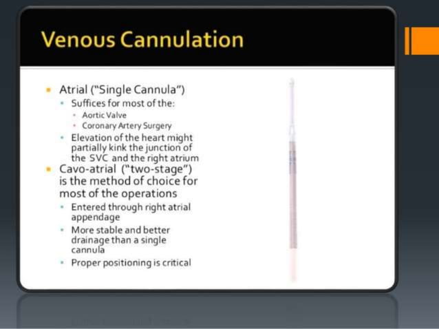 Cannulation and cardiopulmonary bypass. | PPTX