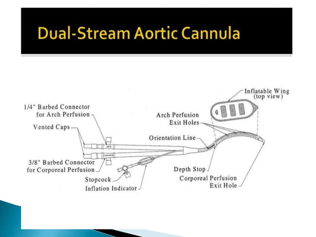 Cannulation and cardiopulmonary bypass. | PPTX