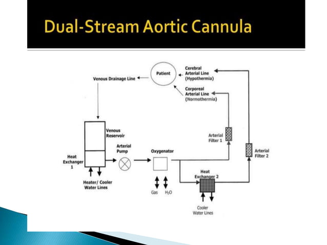Cannulation and cardiopulmonary bypass. | PPTX