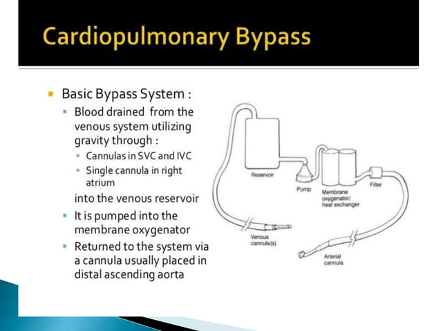 Cannulation and cardiopulmonary bypass. | PPTX