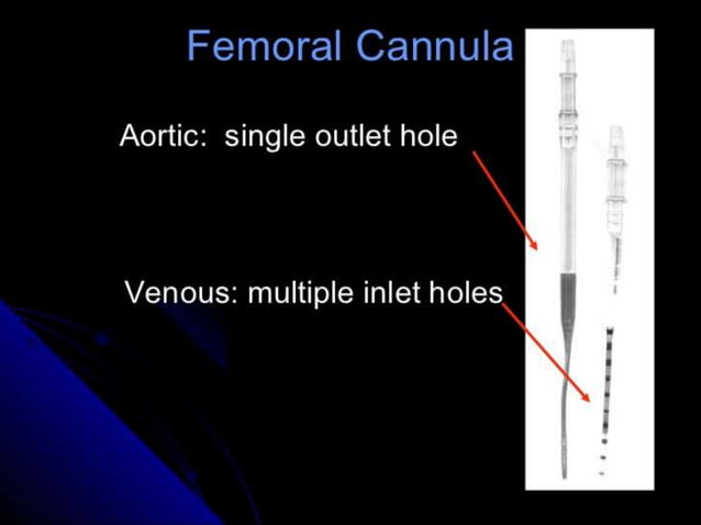 Cannulation and cardiopulmonary bypass. | PPT