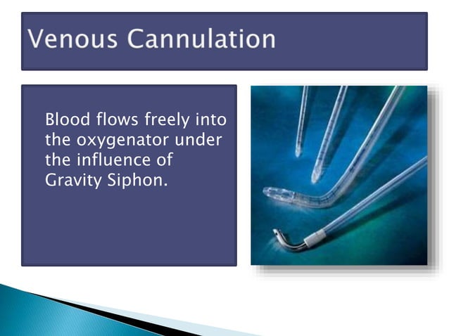 Cannulation and cardiopulmonary bypass. | PPT