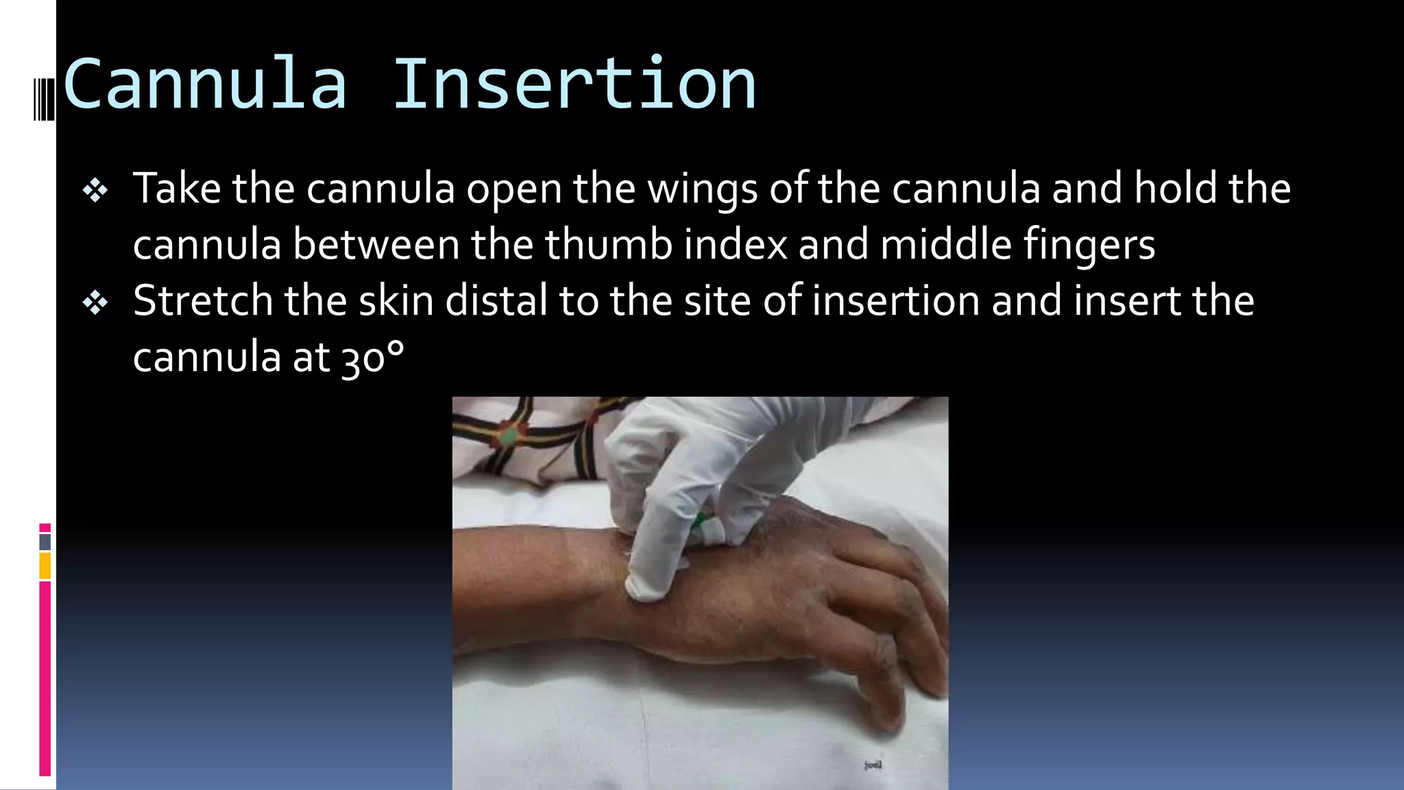 Cannulation and complications | PPTX