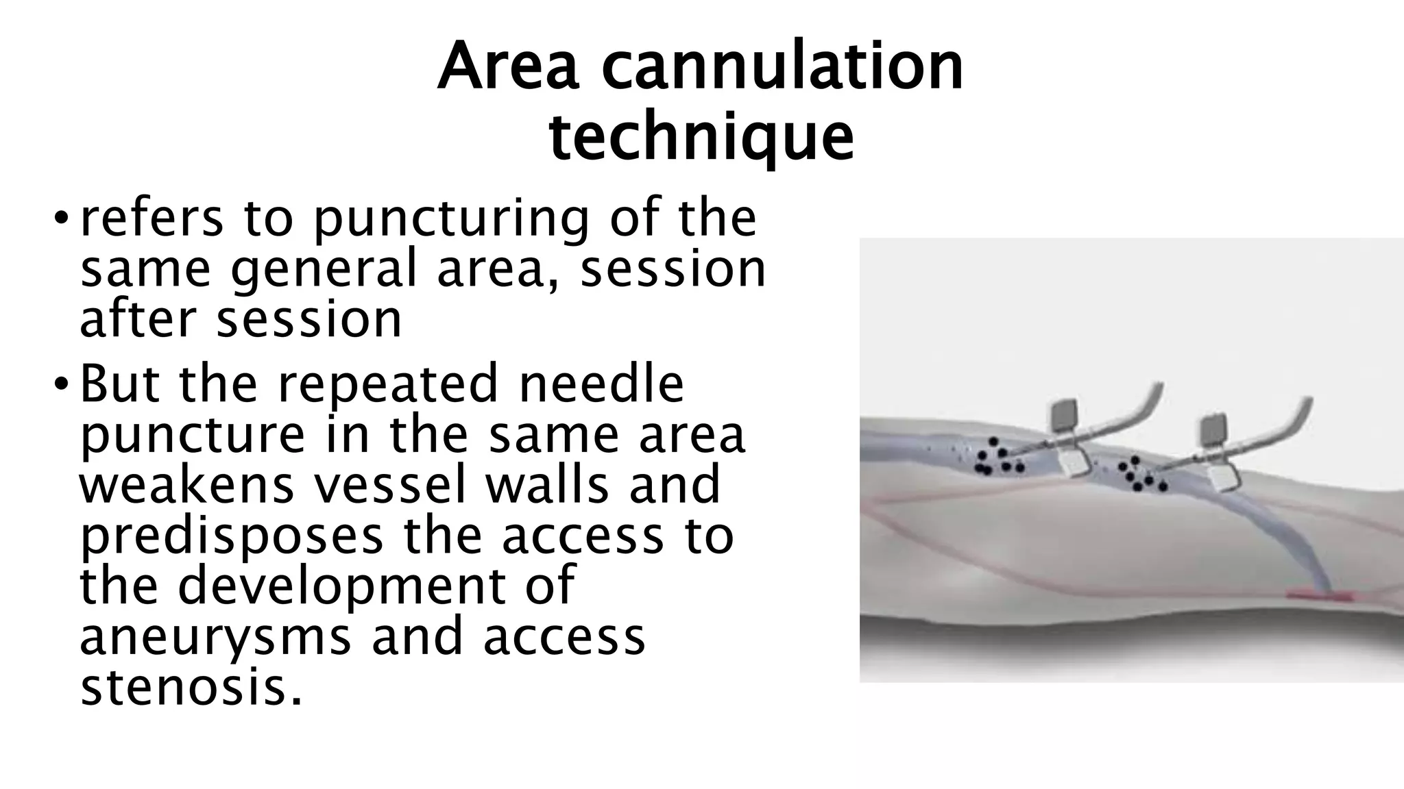 CANNULATION PROCEDURE.pptx