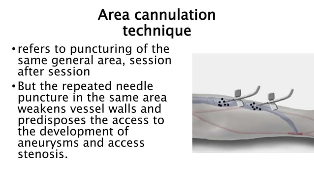 CANNULATION PROCEDURE.pptx