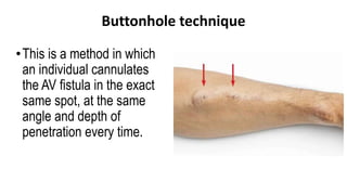 CANNULATION PROCEDURE.pptx