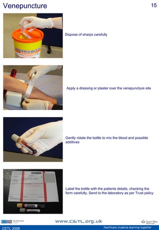 Cannulation venepuncture print | PDF | Blood Disorders | Diseases and ...