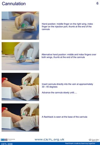 Cannulation venepuncture print | PDF | Blood Disorders | Diseases and ...