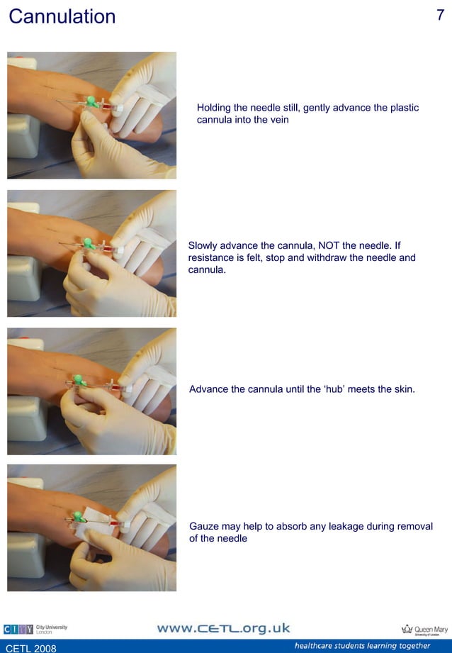 Cannulation venepuncture print | PDF | Blood Disorders | Diseases and ...