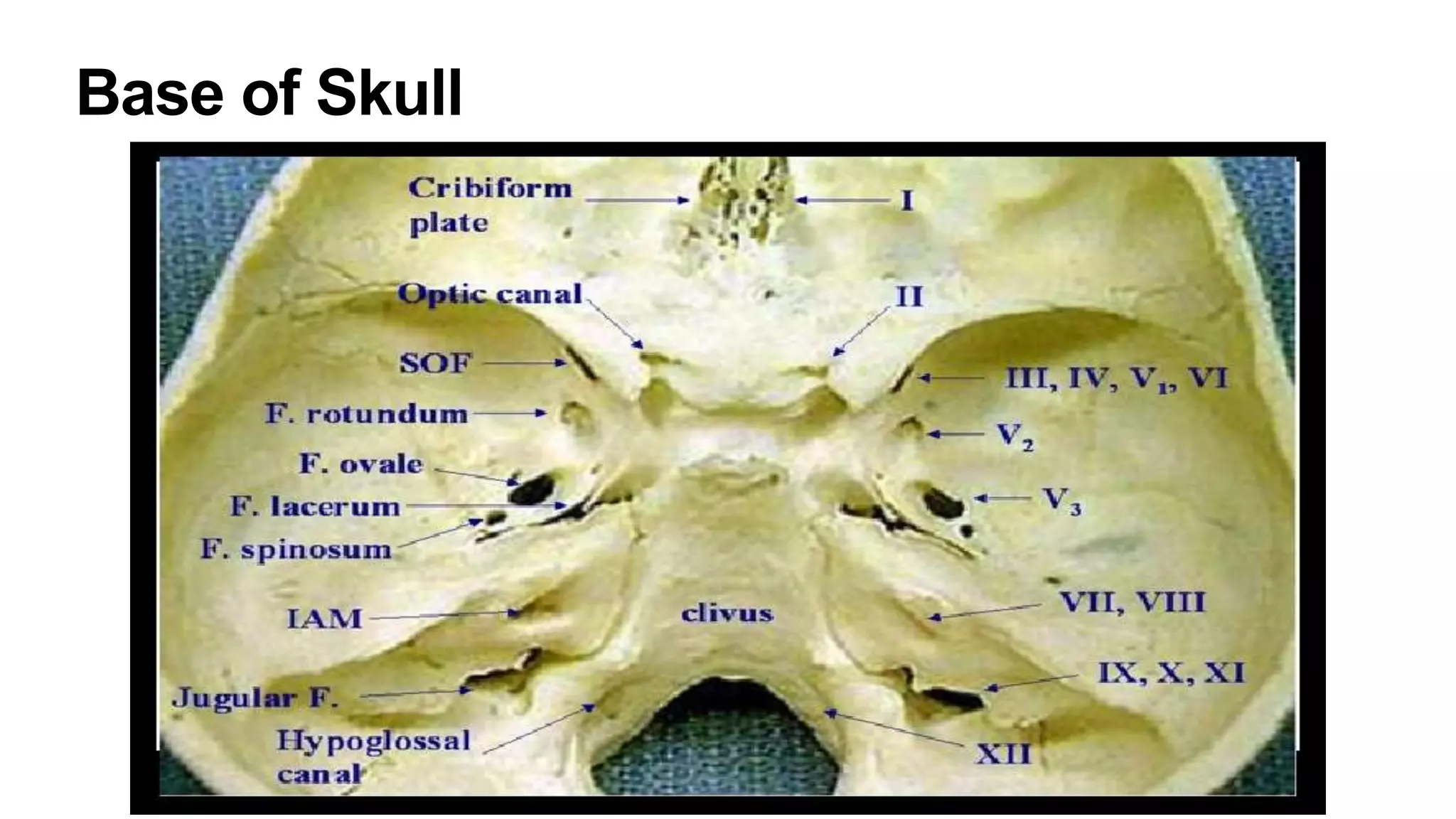 Ca Nasopharynx contouring.pptx