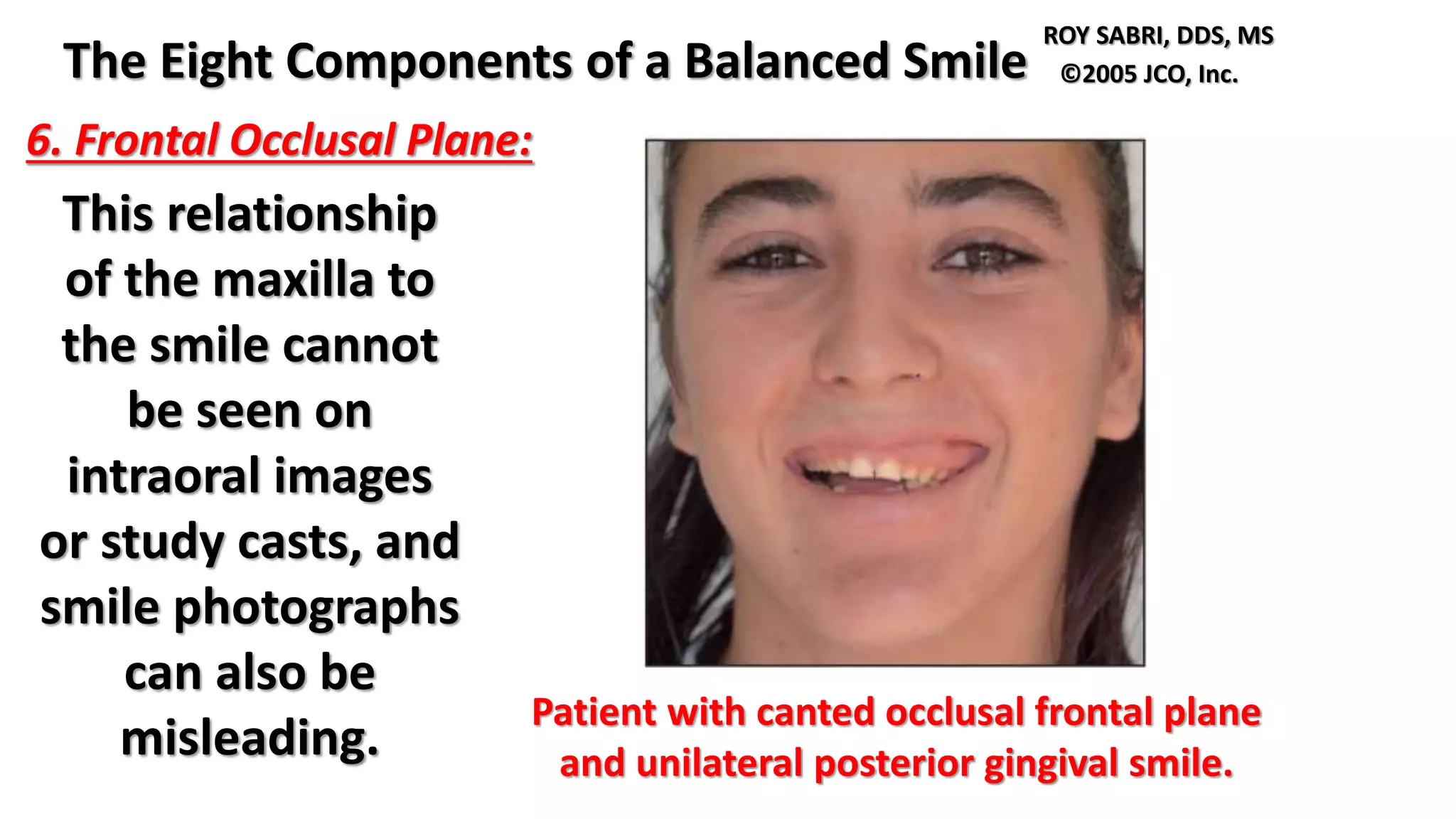 Canted occlusal plane ; etiology and evaluation part 1 | PPTX