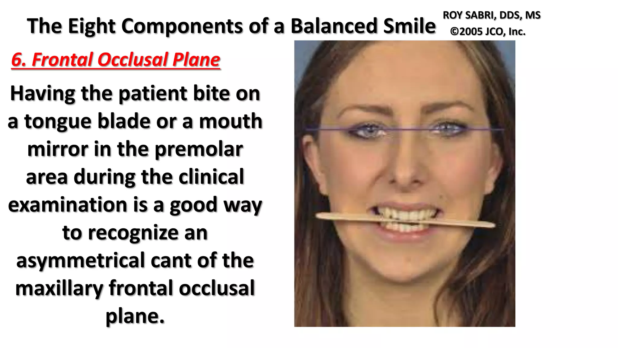 Canted occlusal plane ; etiology and evaluation part 1 | PPTX