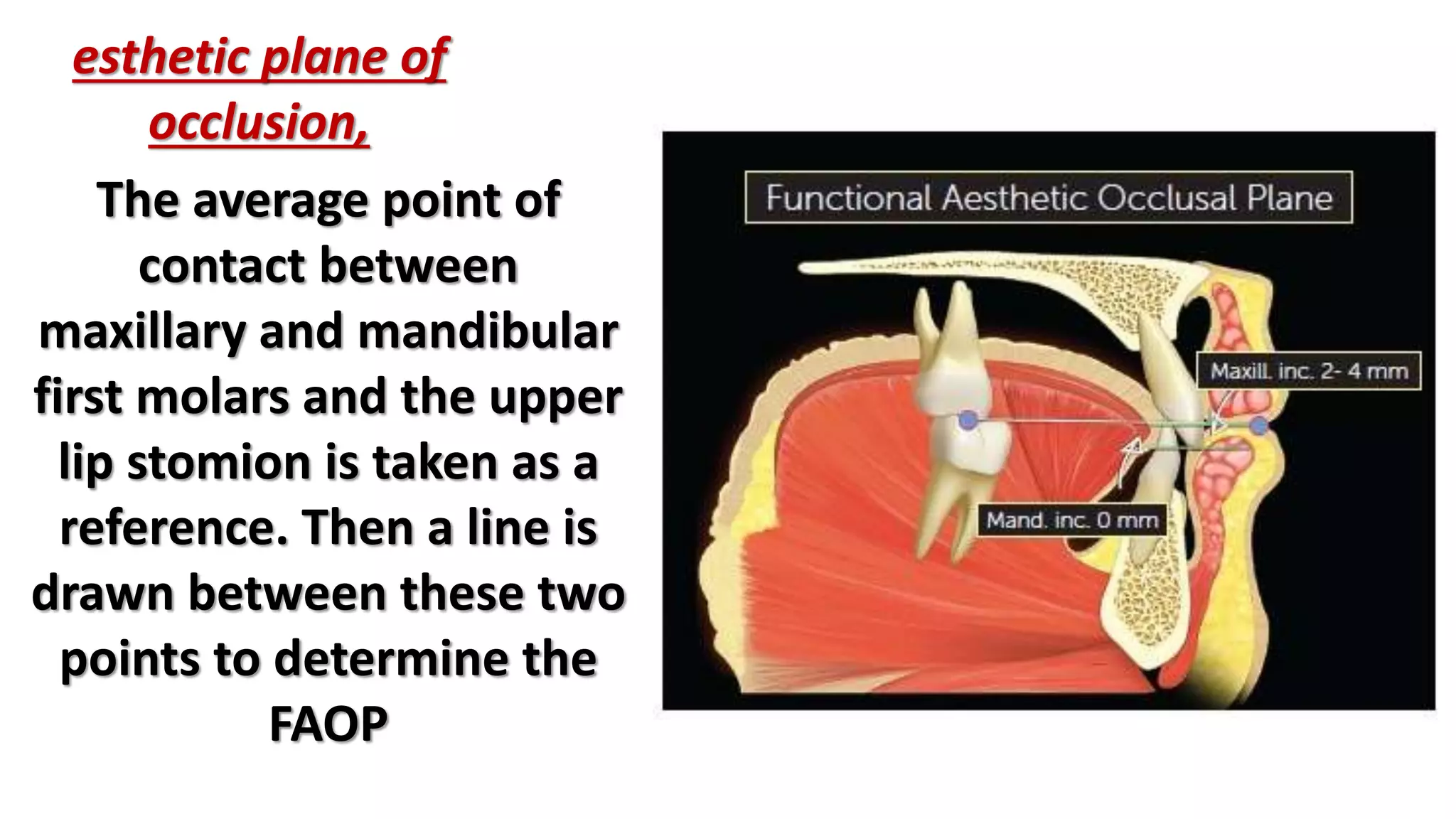 Canted occlusal plane ; etiology and evaluation part 1 | PPTX