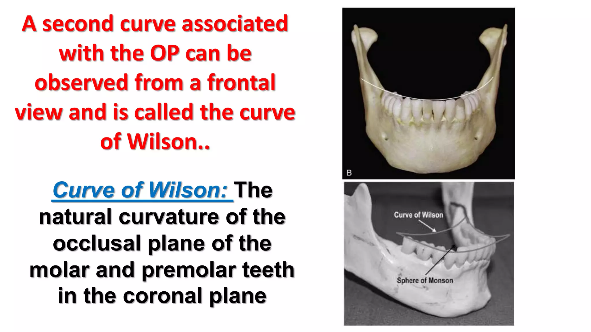 Canted occlusal plane ; etiology and evaluation part 1 | PPTX