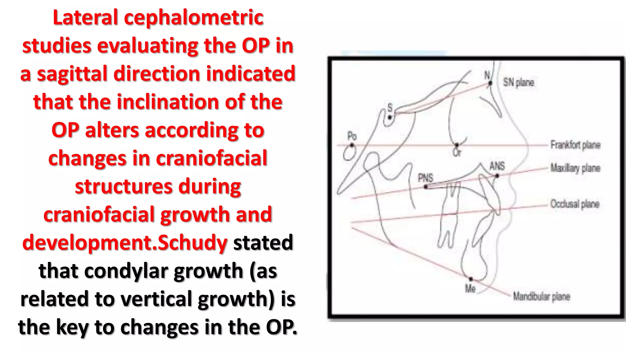 Canted occlusal plane ; etiology and evaluation part 1 | PPTX