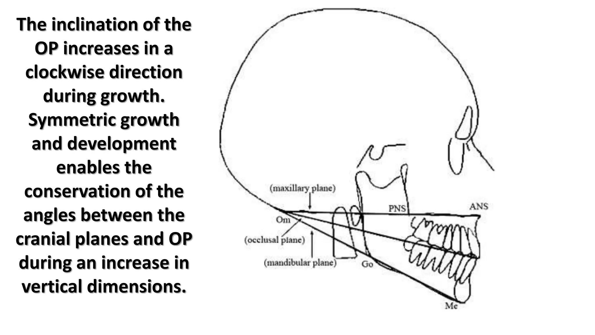 Canted occlusal plane ; etiology and evaluation part 1 | PPTX