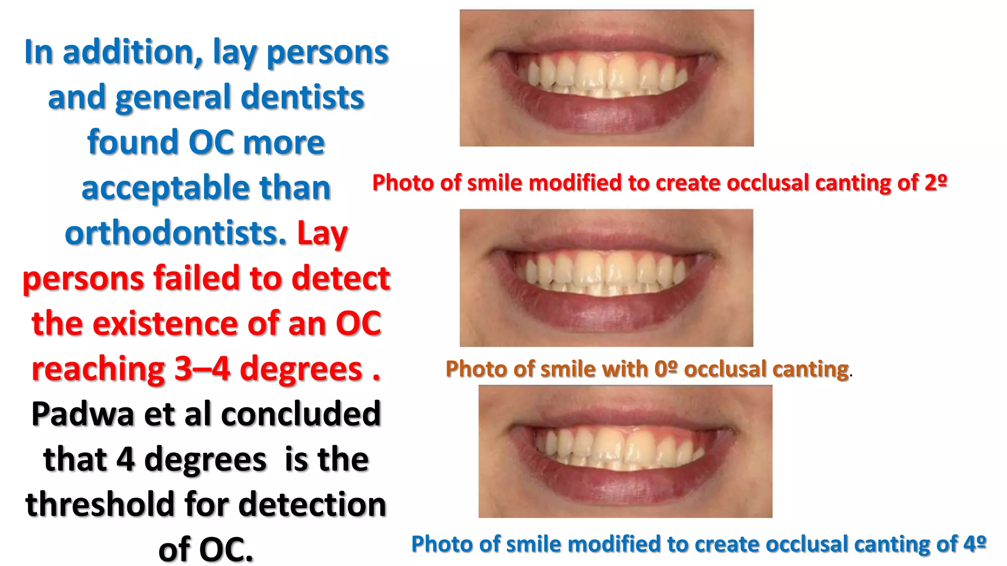 Canted occlusal plane ; etiology and evaluation part 1 | PPTX