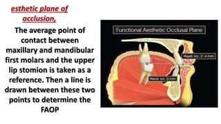 Canted occlusal plane ; etiology and evaluation part 1 | PPTX