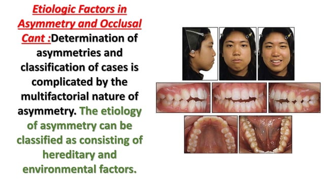 Canted occlusal plane ; etiology and evaluation part 1 | PPTX | Dental ...
