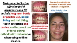 Canted occlusal plane ; etiology and evaluation part 1 | PPTX