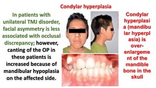 Canted occlusal plane ; etiology and evaluation part 1 | PPTX