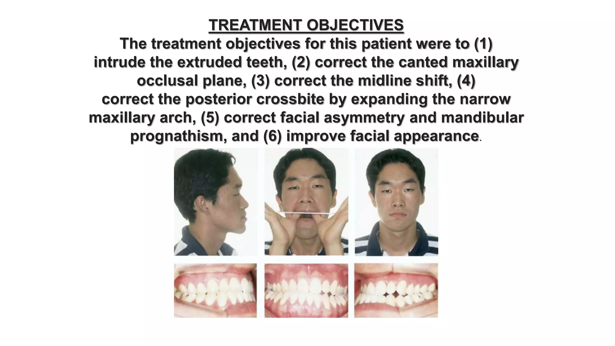 ORTHODONTIC CORRECTION OF OCCLUSAL PLANE CANTING | PPTX | Dental Health | Diseases and Conditions