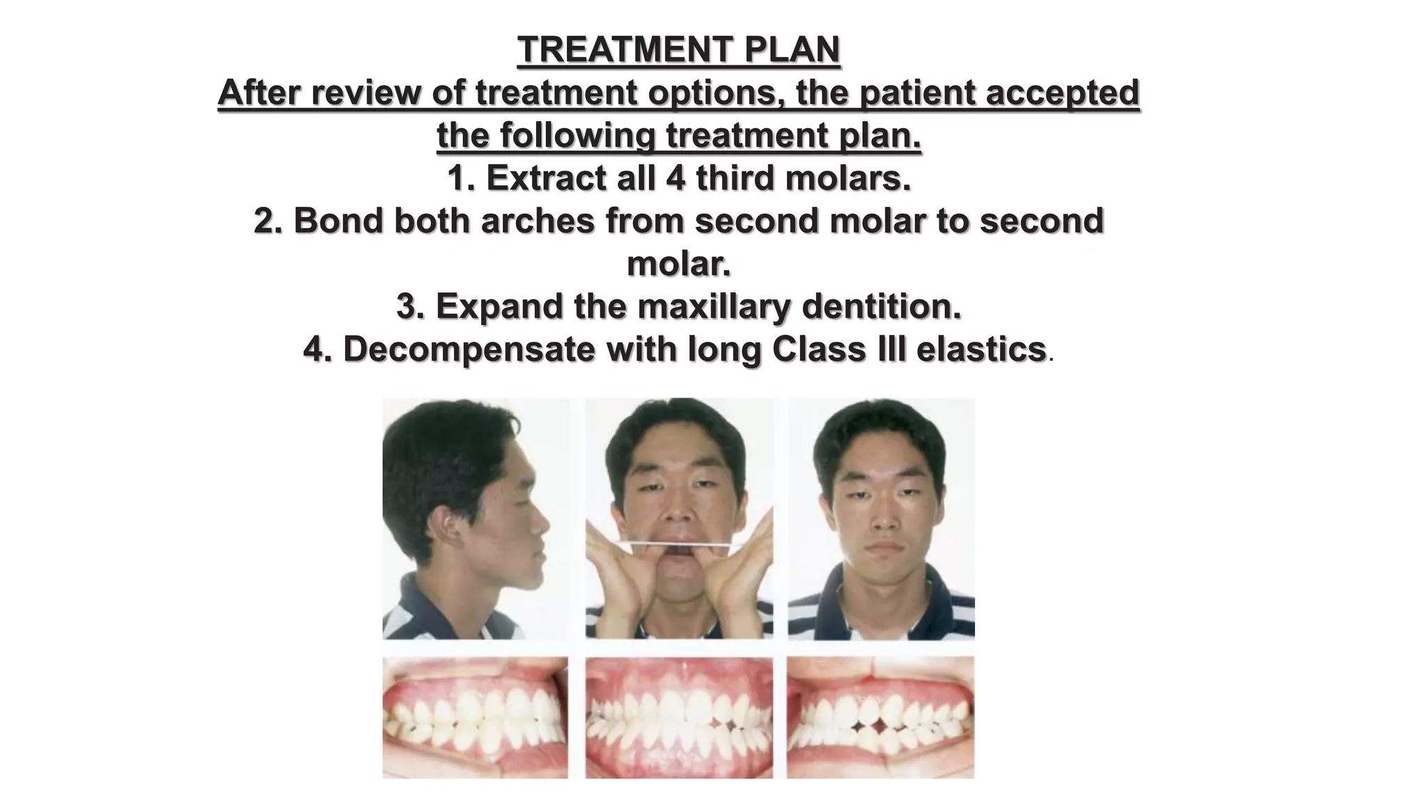 ORTHODONTIC CORRECTION OF OCCLUSAL PLANE CANTING | PPTX
