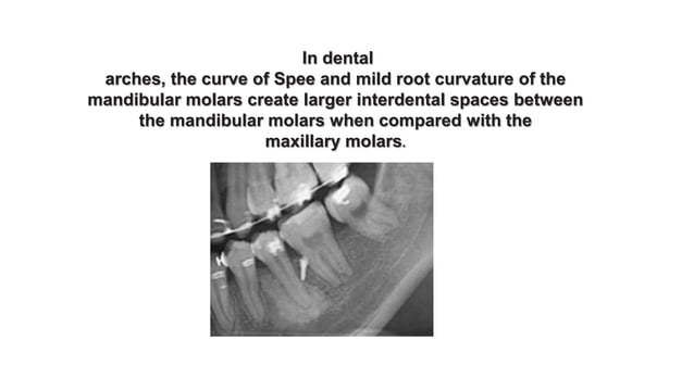 ORTHODONTIC CORRECTION OF OCCLUSAL PLANE CANTING | PPTX | Dental Health ...