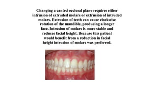 ORTHODONTIC CORRECTION OF OCCLUSAL PLANE CANTING | PPTX
