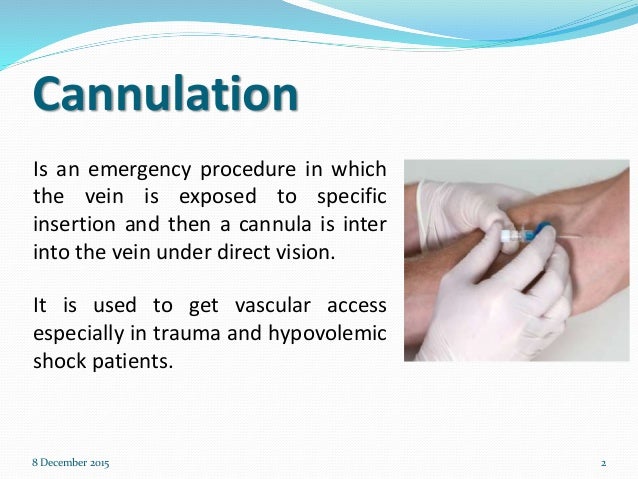 Canulation and iv therapy