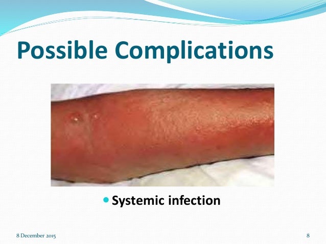 Canulation and iv therapy