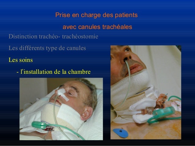 Trachéotomie et trachéostomie (Indications, prise en charge des patie…