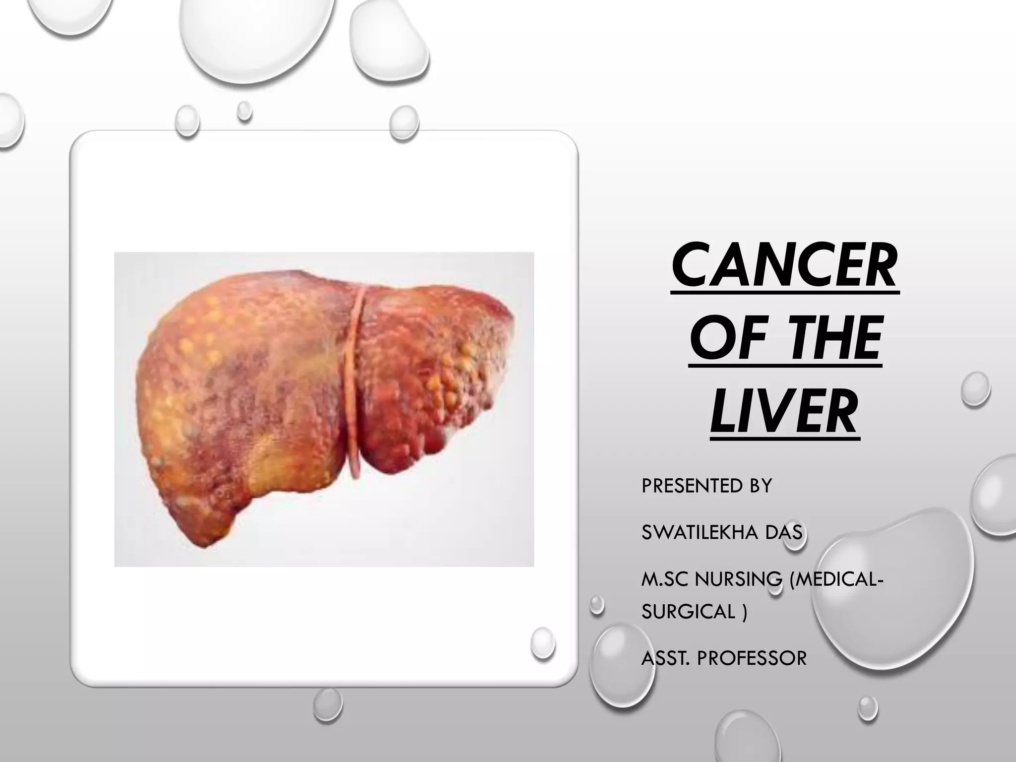 Cancer of liver - Easy ppt for Student Nurses | PDF