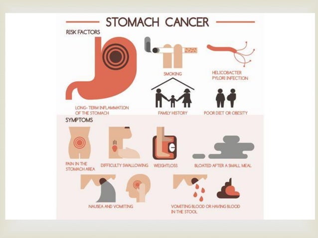 Cancer of Stomach - Easy explanation for Nurses- | PDF | Digestive ...