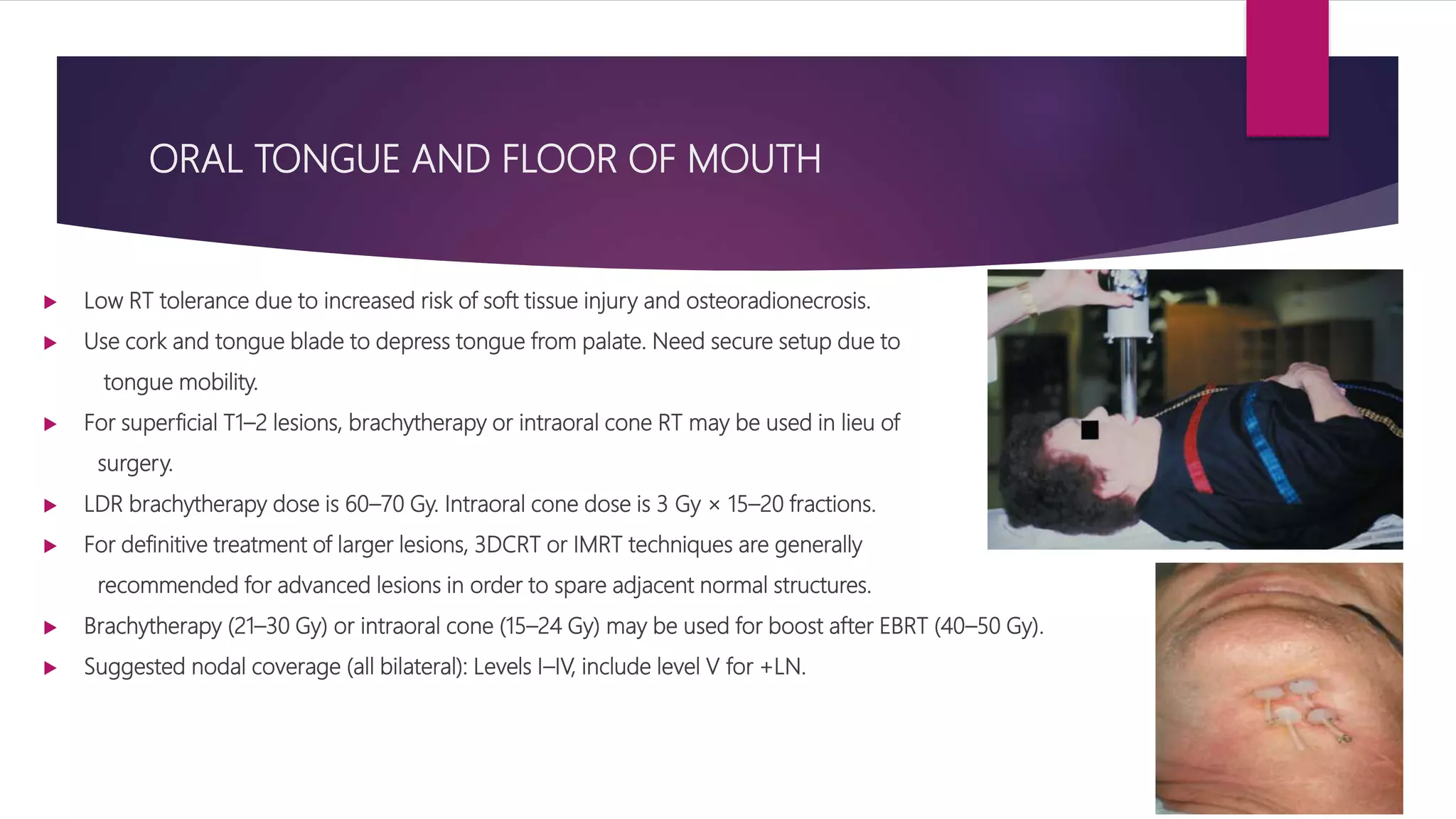 Ca oral cavity management | PPTX