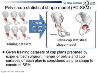 CT-based Automated Preoperative Planning of Acetabular Cup Size and ...