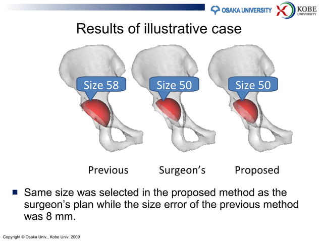 CT-based Automated Preoperative Planning of Acetabular Cup Size and ...