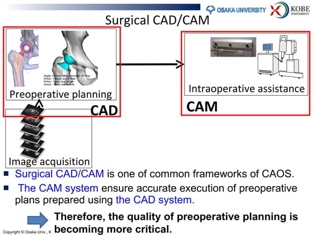 CT-based Automated Preoperative Planning of Acetabular Cup Size and ...