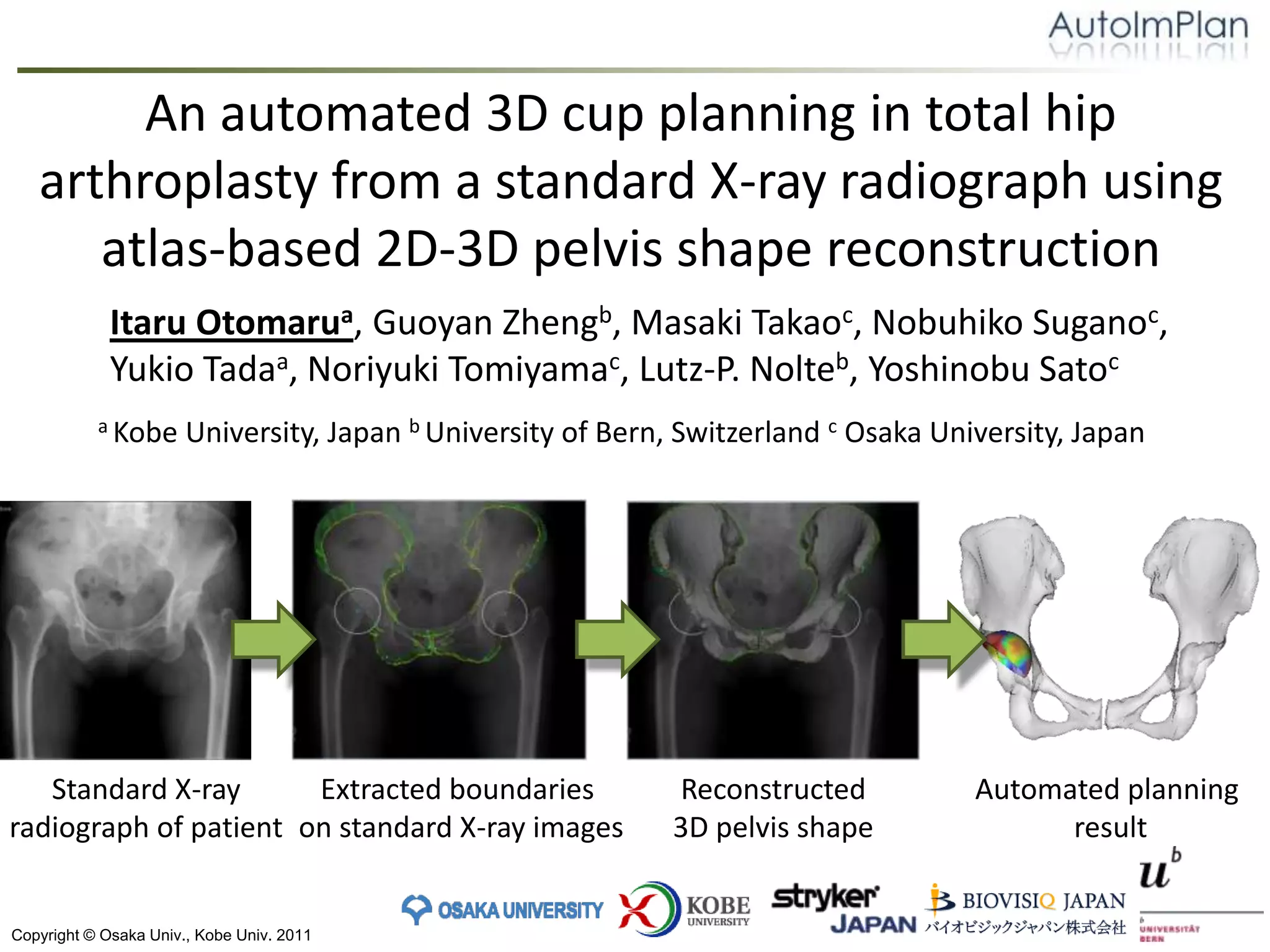 An automated 3D cup planning in total hip arthroplasty from a standard X‑ray radiograph using ...