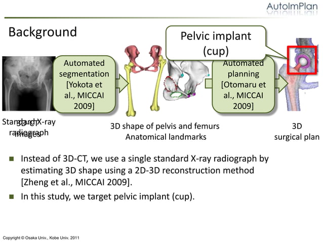 An automated 3D cup planning in total hip arthroplasty from a standard ...