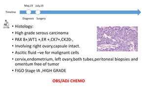 ca ovary case.pptx