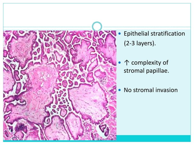 Ca ovary staging(AJCC 8th Edition& FIGO 2014) and classification | PPTX ...