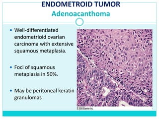 Ca ovary staging(AJCC 8th Edition& FIGO 2014) and classification | PPTX