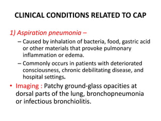 Community Acquired Pneumonia | PPTX