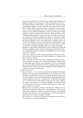 Hernia inguinal laparoscópica | PDF