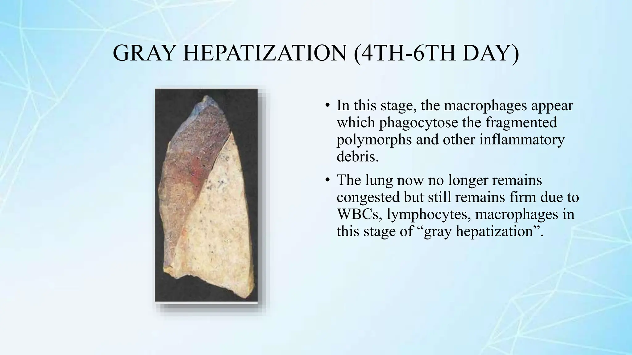 Community Acquired Pneumonia.pptx