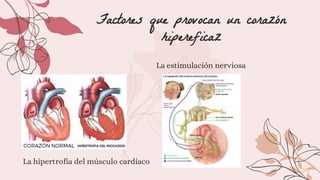 Cap 20 - GASTO CARDÍACO, RETORNO VENOSO Y SU REGULACIÓN | PPTX